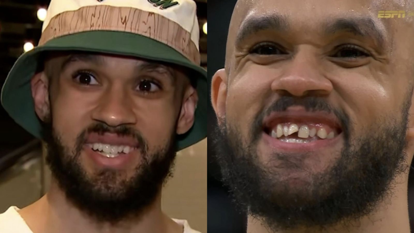 【影片】NBA / White牙齒即時修復趕上遊行：感謝波士頓牙醫，他們太關鍵了 | 籃球筆記