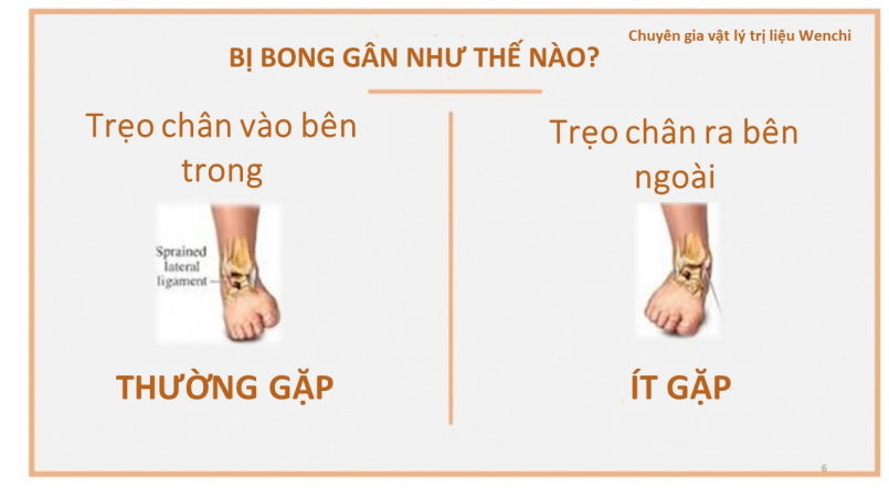 [Ngừa Chấn Thương] Những Điều Cần Biết Về Bong Gân ｜ Biji Vietnam